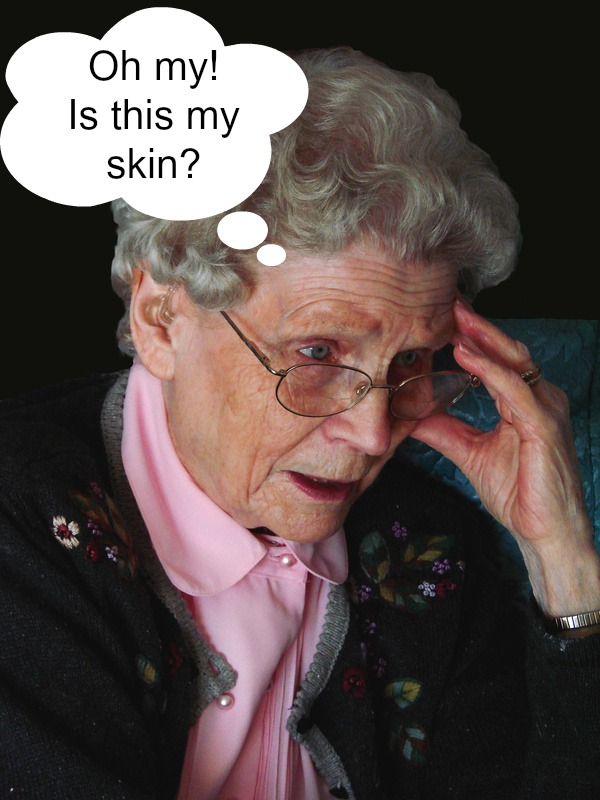 Elderly Skin Conditions series – Elderly Skin, How does Skin Age ...